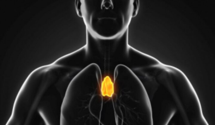 Cuando el órgano más desconocido debe ser extirpado (el timo)